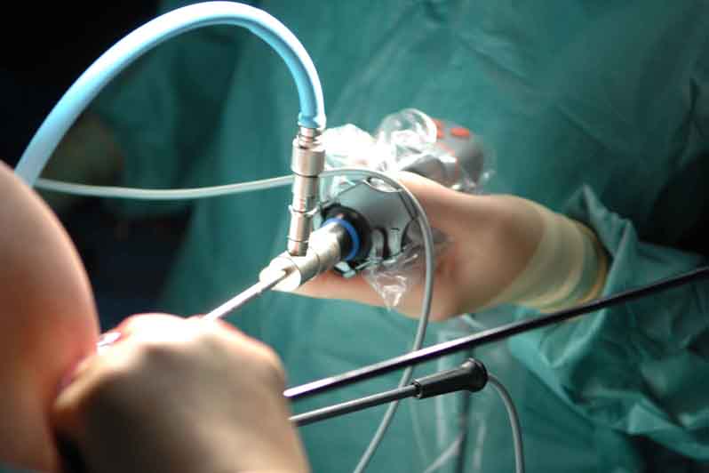 Surgery for varicose veins » The Vein Clinic